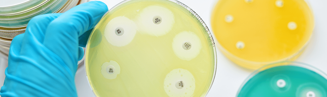 Cell-on-Chip - 10 facts for successful cell cultivation - CETONI GmbH